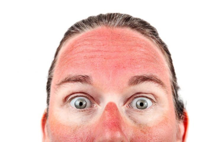 Why Avoiding The Sun Is As Dangerous as Smoking